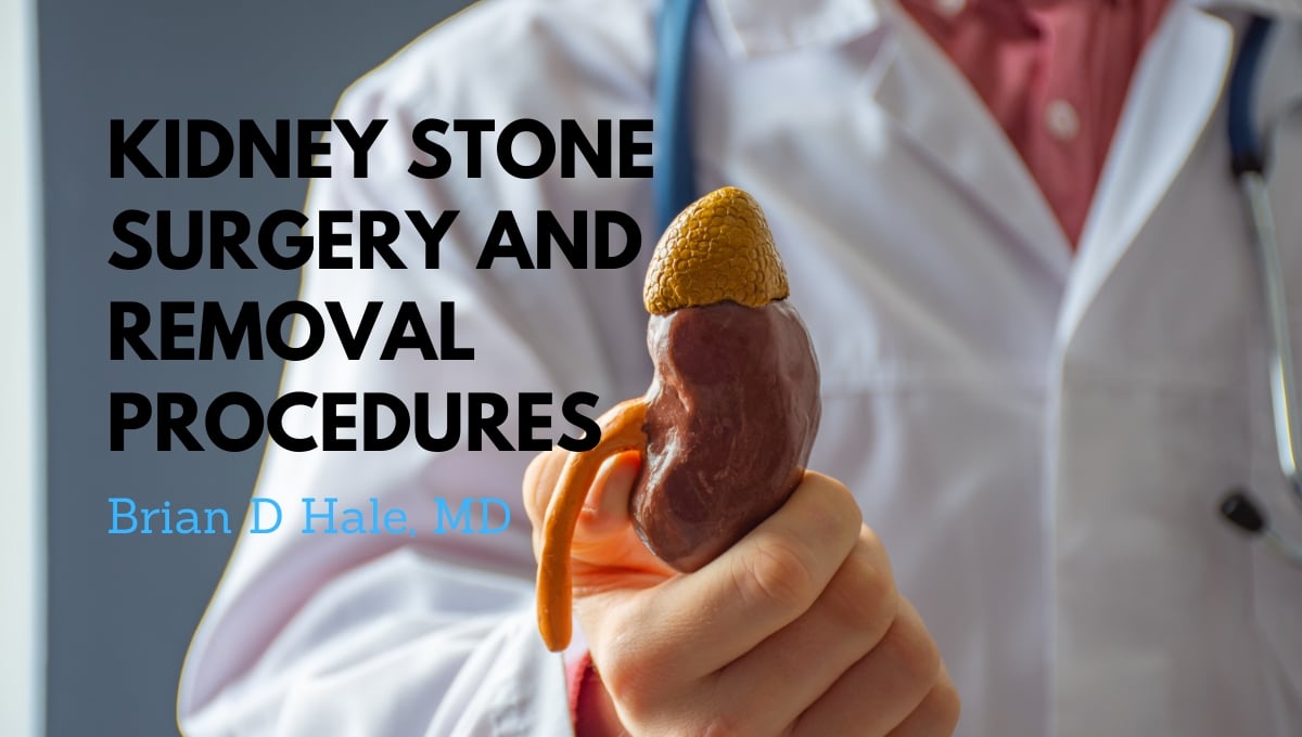 Kidney Stone Removal Online